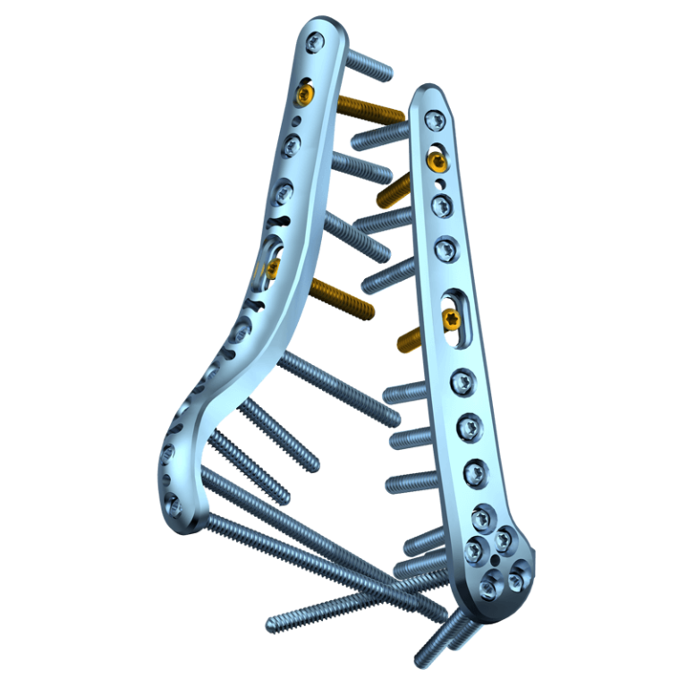 TRILOCK DISTAL RADIUS FRAME PLATES 2.5, DORSAL – Promedionics